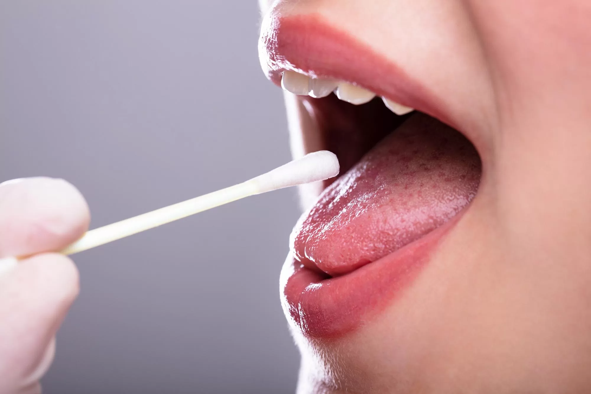Researchers Develop New Saliva Test to Rapidly Identify Paracetamol ...