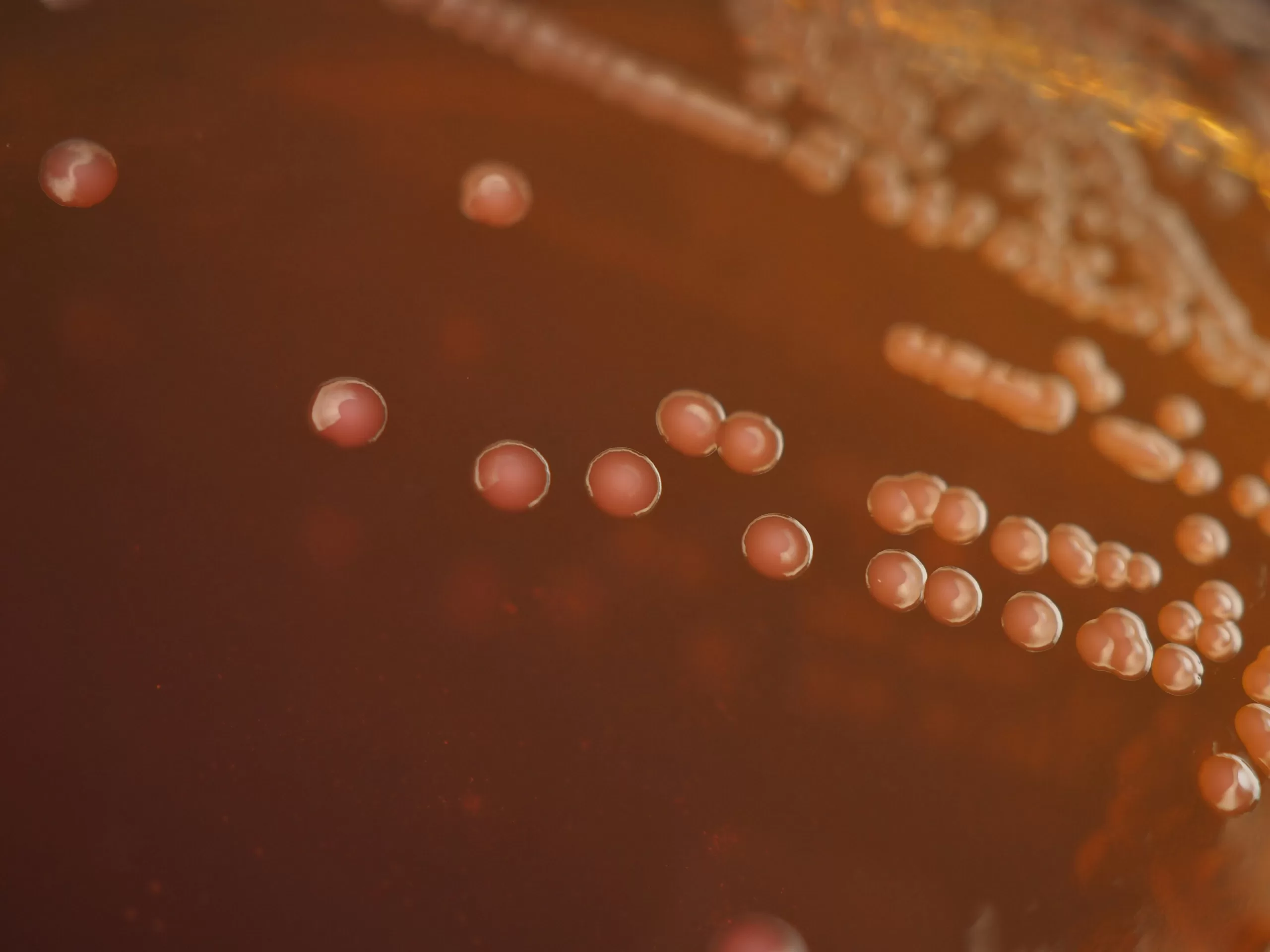 Doctors Identify 'Alarming' New Strain of Drug-Resistant Bacteria in ...