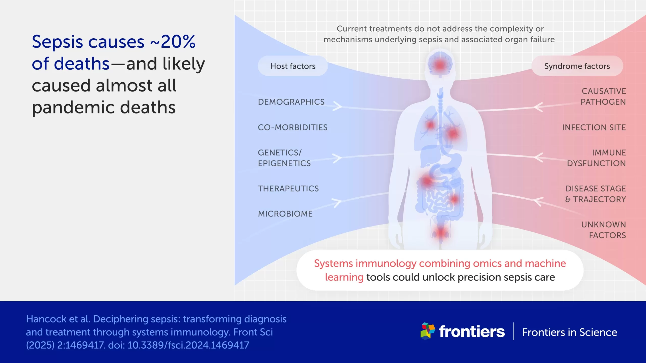 Tackling Sepsis Could Save Millions of Lives and Reduce Future Pandemic ...