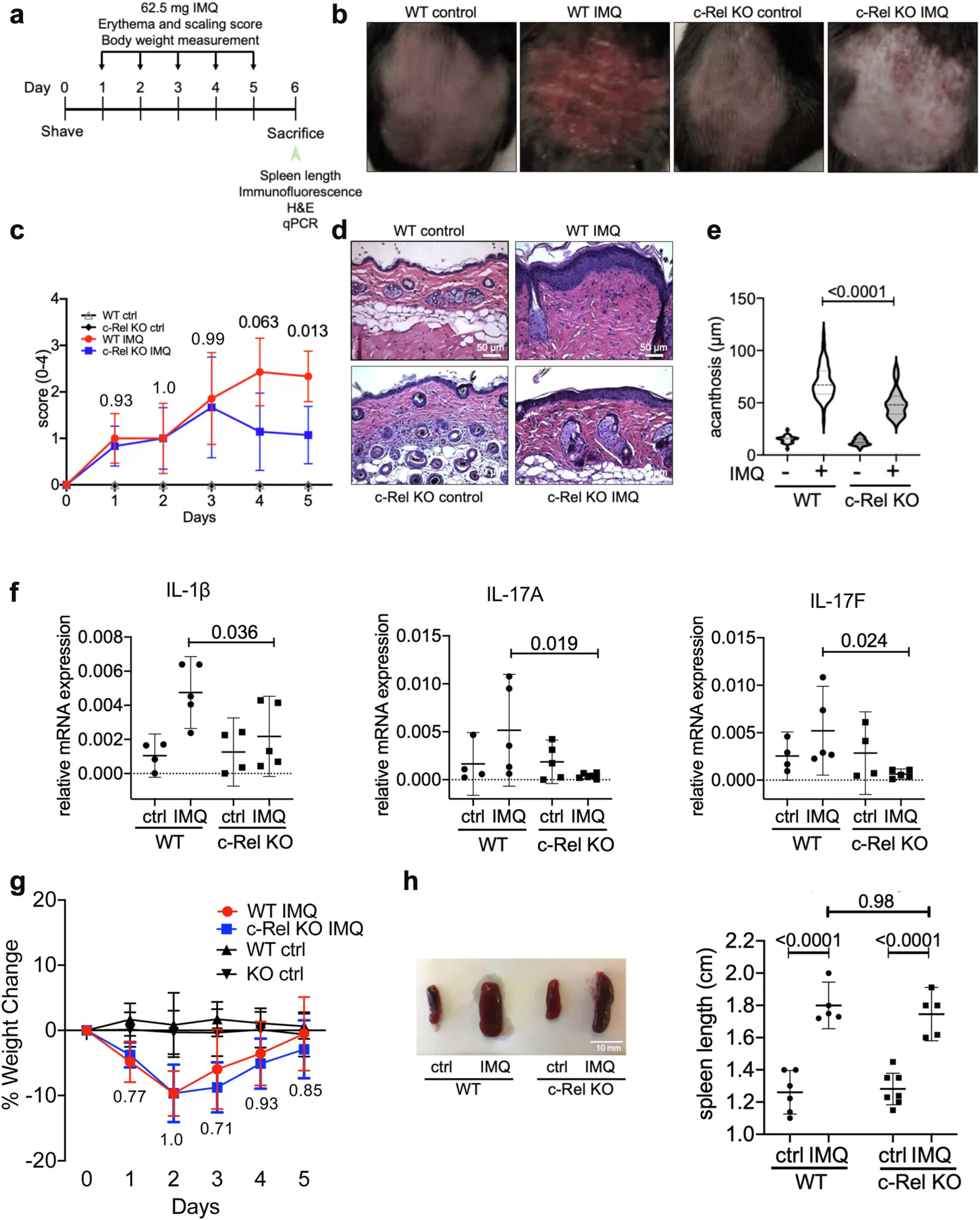 Key Protein that Intensifies Psoriasis Identified in Groundbreaking ...